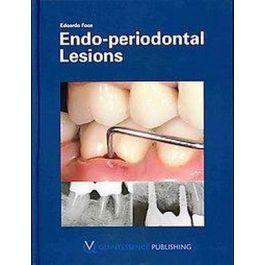 Endo-periodontal Lesions