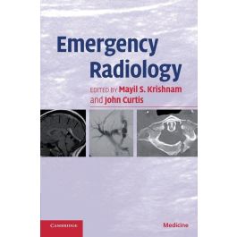 Emergency Radiology: 9780521672474: Emergency, Radiology: Health ...