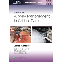 Manual of Airway Management in Critical Care: 9781975214203: Medicine ...